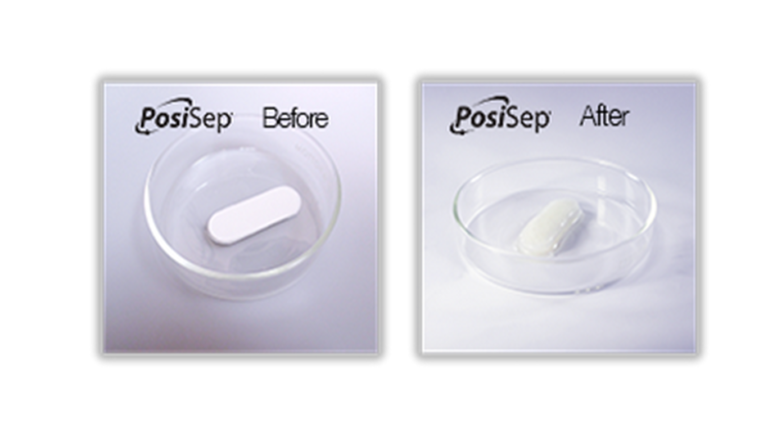 PosiSep-Dry-and-Hydrated-Large - Endovision BV